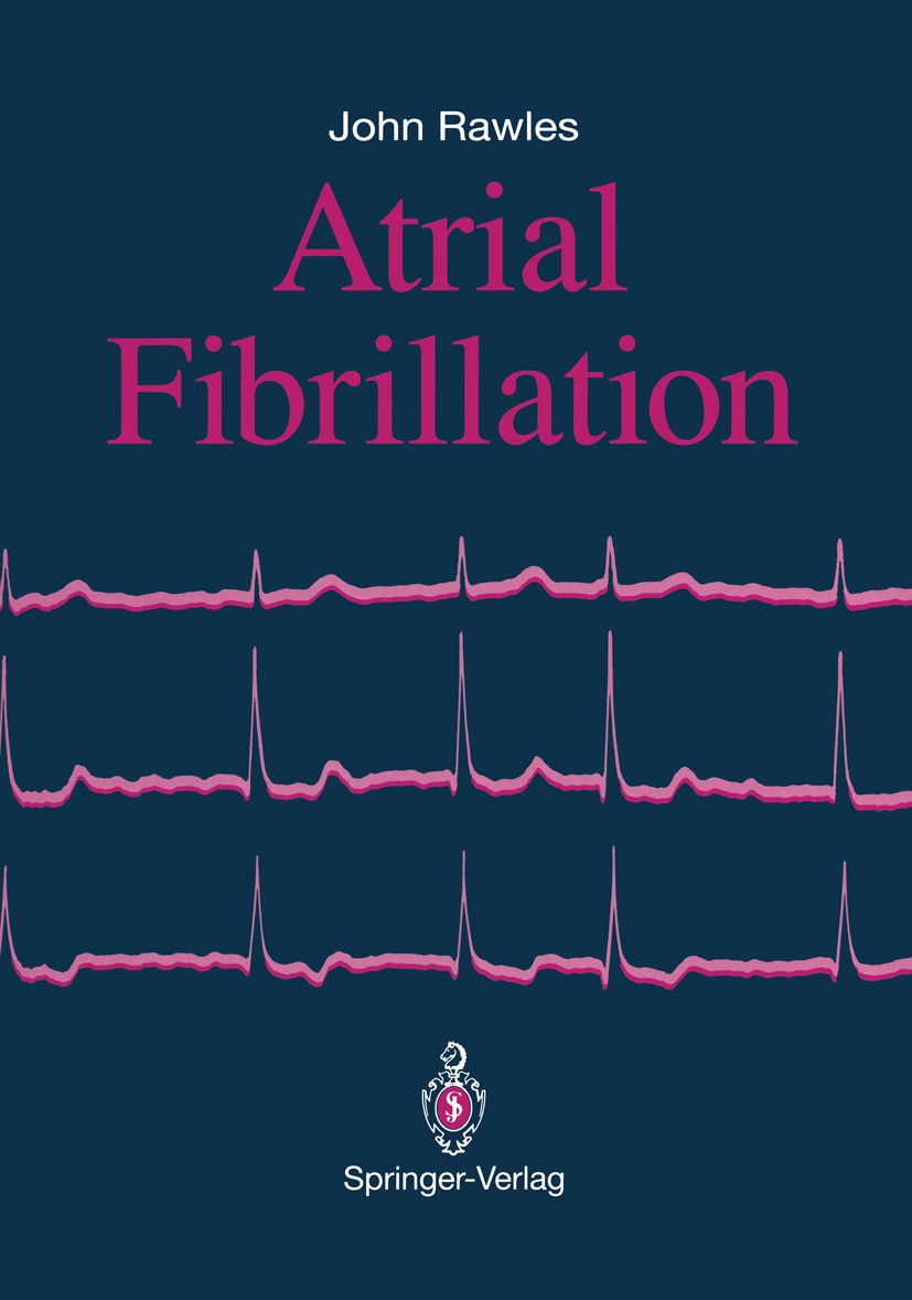 Charts AI Diagnoses Atrial Fibrillation In Normal Sinus, 46% OFF