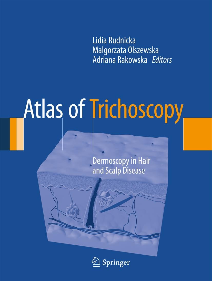 Atlas of Trichoscopy: Dermoscopy in Hair and Scalp Disease SpringerLink