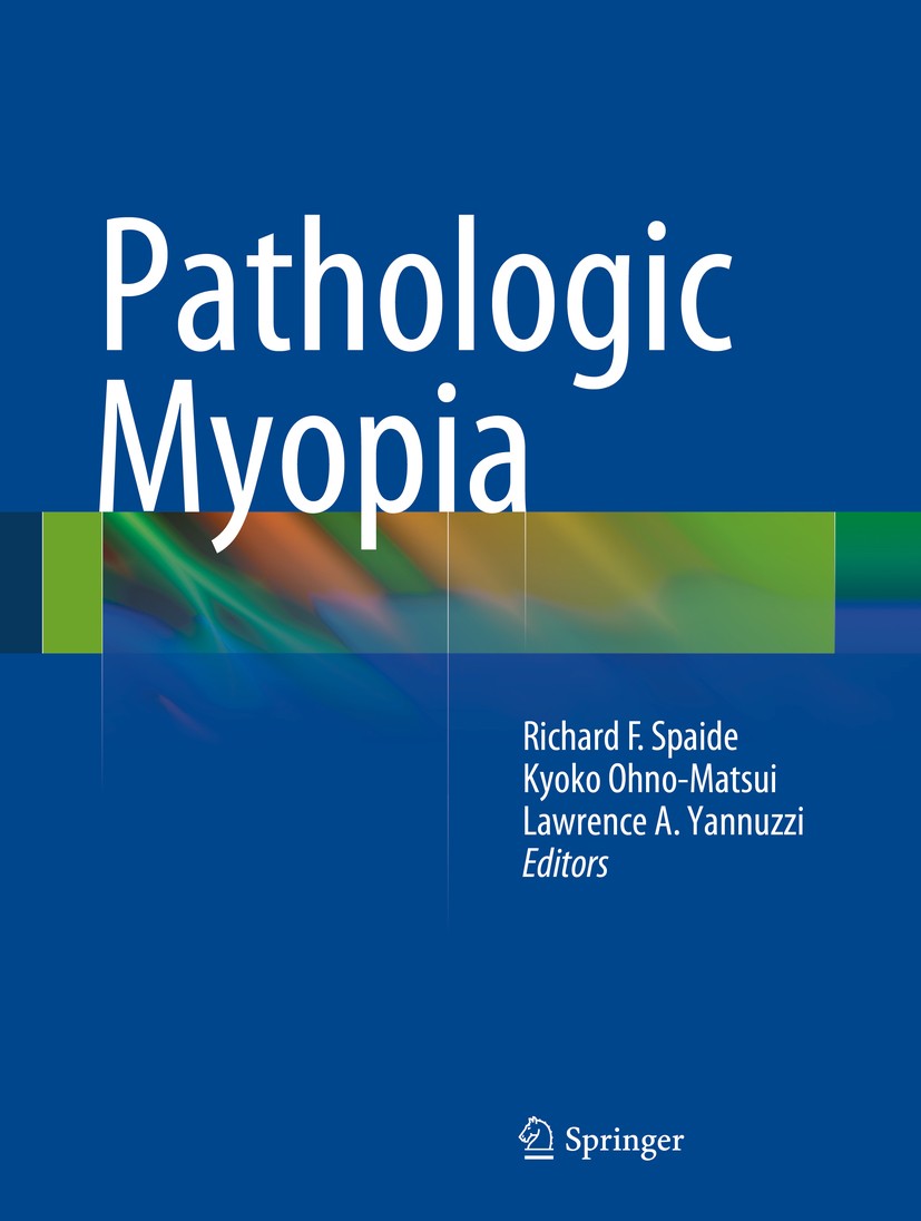 Genes Involved in the Development of Myopia | SpringerLink