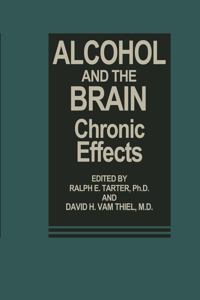 Brain On Alcohol Poster