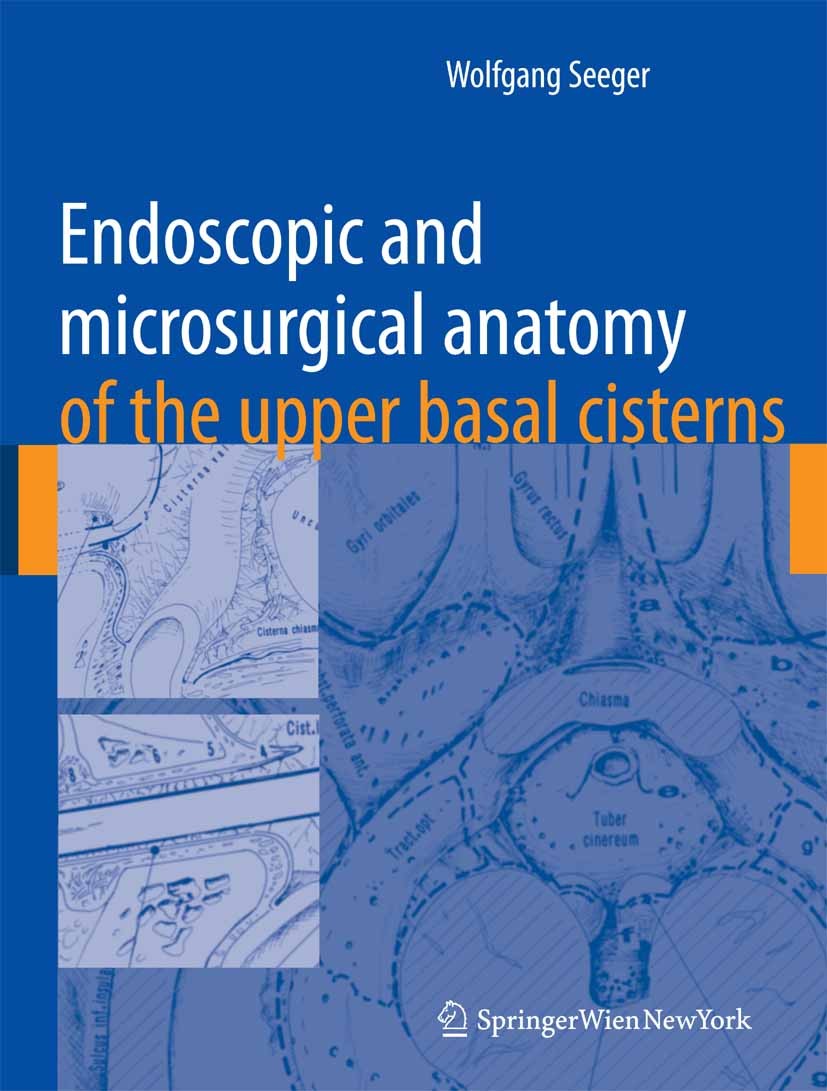 Basal Cistern Anatomy Suprasellar Cistern | Radiology Reference