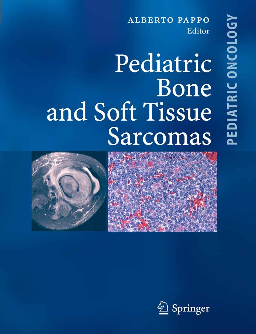 Pediatric Bone and Soft Tissue Sarcomas | SpringerLink