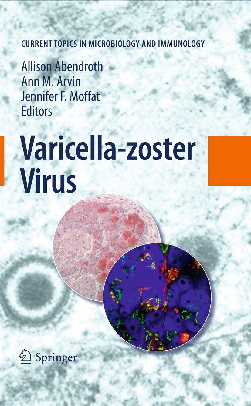 Varicella Virus