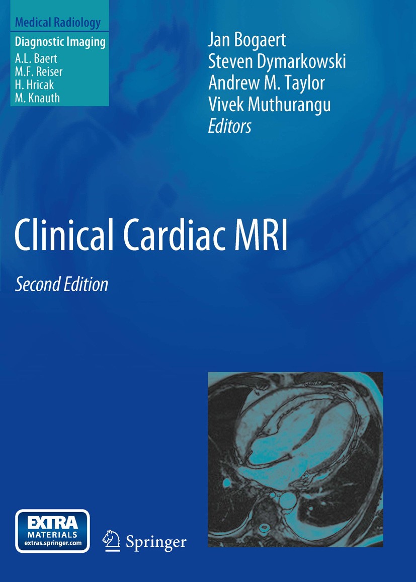 CMR Assessment Of Cardiac Masses SpringerLink, 47% OFF