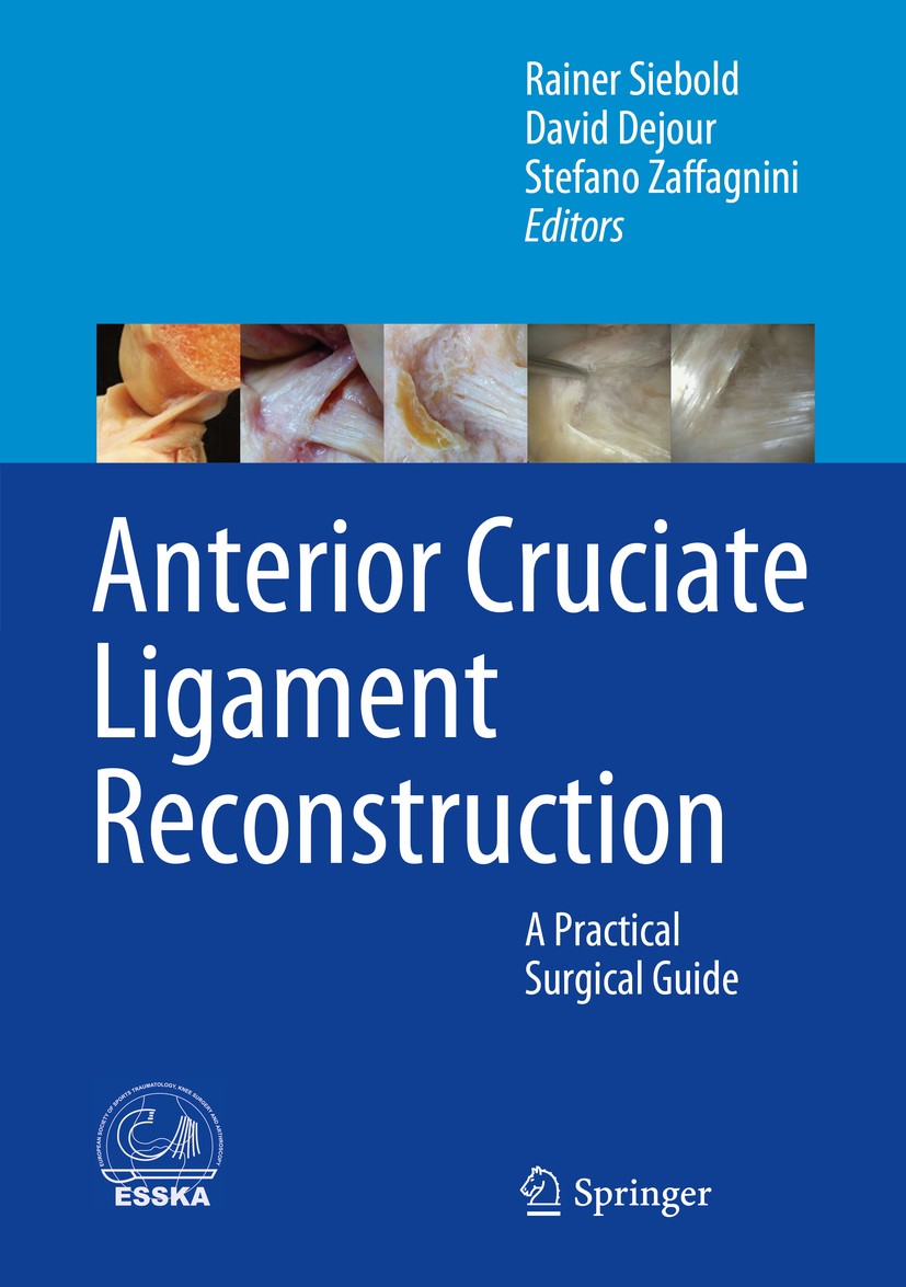 Anterior Cruciate Ligament Reconstruction Surgery