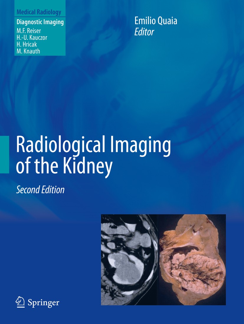 Kidney Imaging Radiology Imaging And Management Of Incidental Renal