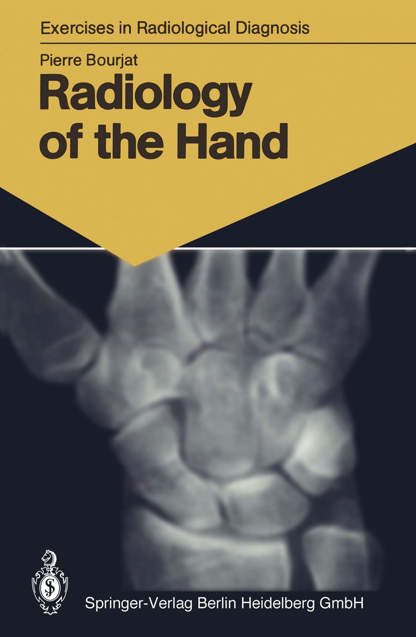 Hand Anatomy Hand Anatomy Medical Radiography Medical Imaging