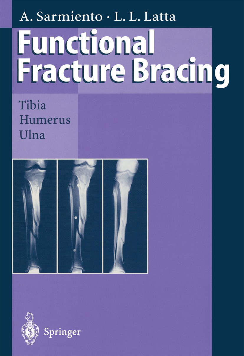 Functional Brace Humerus
