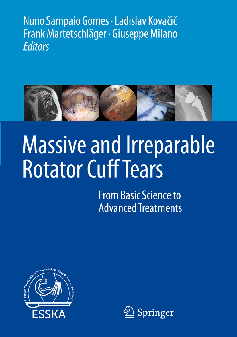 Rotator Cuff Tear Pathogenesis Evaluation And Treatment Springerlink Ph