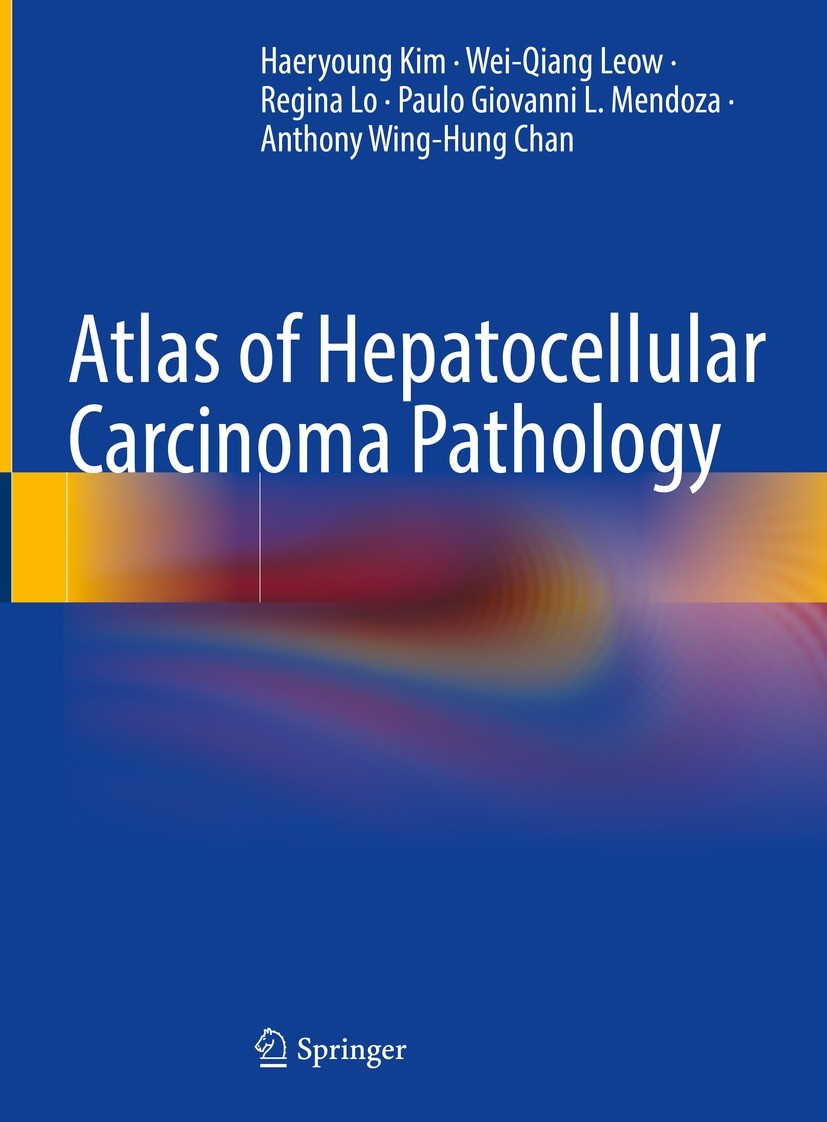 Liver Atlas Diagnosis Hepatocellular Carcinoma Hcc Clinical