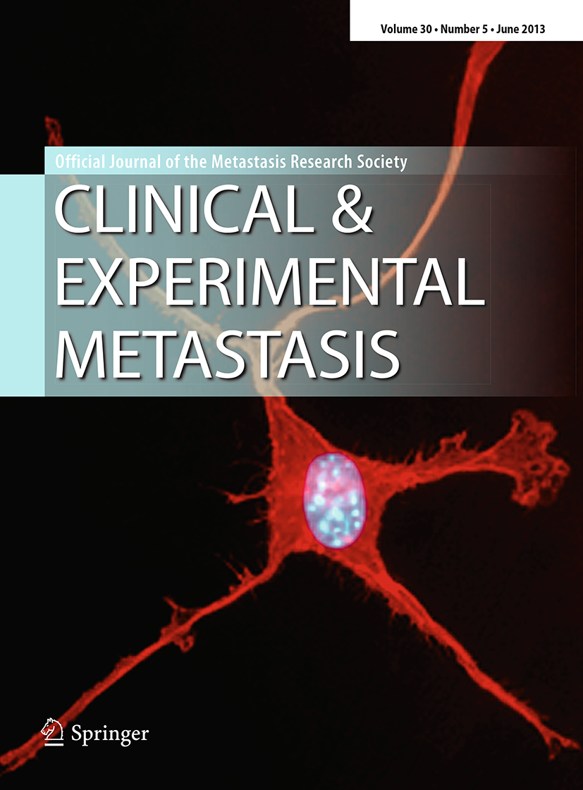 Editorial: Cancer metastasis through the lymphovascular system ...