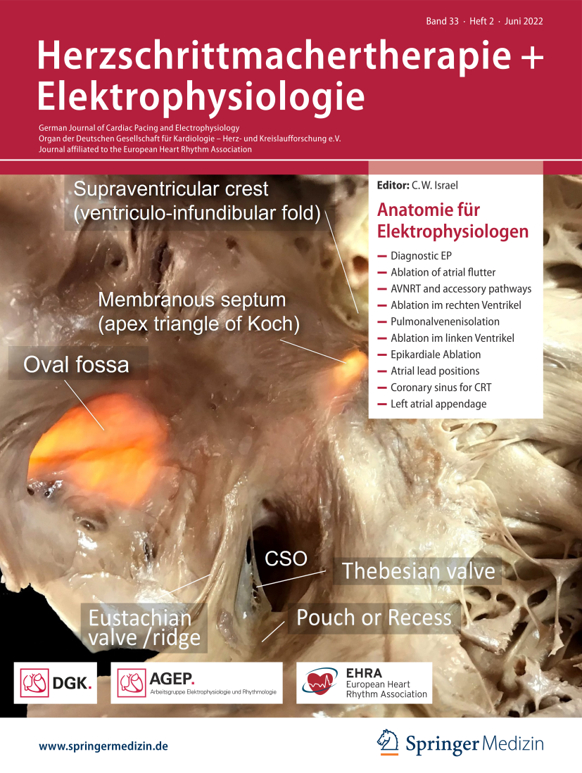 Safety of His-bundle ablation after pacemaker implantation in patients ...