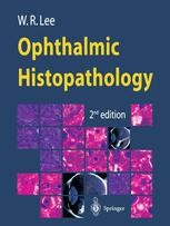 Ophthalmic Histopathology | SpringerLink