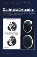 Craniofacial Deformities: Atlas of Three-Dimensional Reconstruction ...