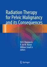 Radiation Therapy for Pelvic Malignancy and its Consequences | Springer Nature Link (formerly ...