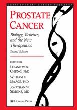 Prostate Cancer: Biology, Genetics, and the New Therapeutics | Springer ...