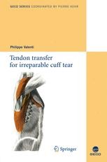 Tendon transfer for irreparable cuff tear | Springer Nature Link ...