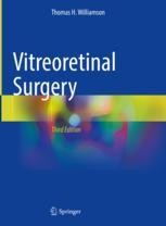 Vitreoretinal Surgery | Springer Nature Link (formally SpringerLink)