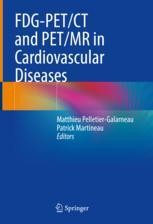 FDG-PET/CT and PET/MR in Cardiovascular Diseases | Springer Nature Link