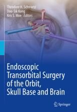 Endoscopic Transorbital Surgery of the Orbit, Skull Base and Brain | SpringerLink