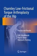 Charnley Low-Frictional Torque Arthroplasty of the Hip: Practice and ...