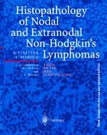 Histopathology of Nodal and Extranodal Non-Hodgkin’s Lymphomas ...