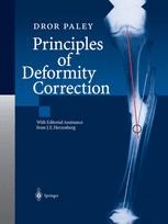 Principles of Deformity Correction | Springer Nature Link (formally ...