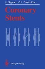 Coronary Stents | SpringerLink