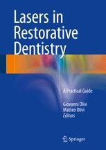 Lasers in Restorative Dentistry: A Practical Guide | Springer Nature ...