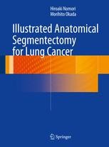 Illustrated Anatomical Segmentectomy for Lung Cancer | SpringerLink