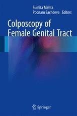 Colposcopy of Female Genital Tract | SpringerLink