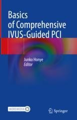 Basics of Comprehensive IVUS-Guided PCI | SpringerLink