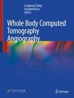 Whole Body Computed Tomography Angiography | SpringerLink
