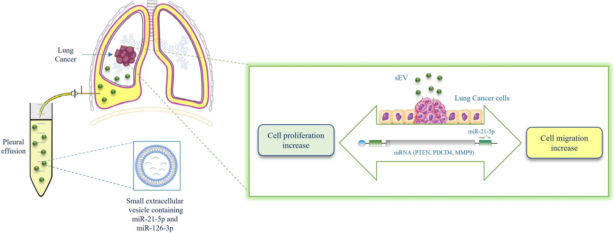 Effects of small extracellular vesicles isolated from pleural effusion ...
