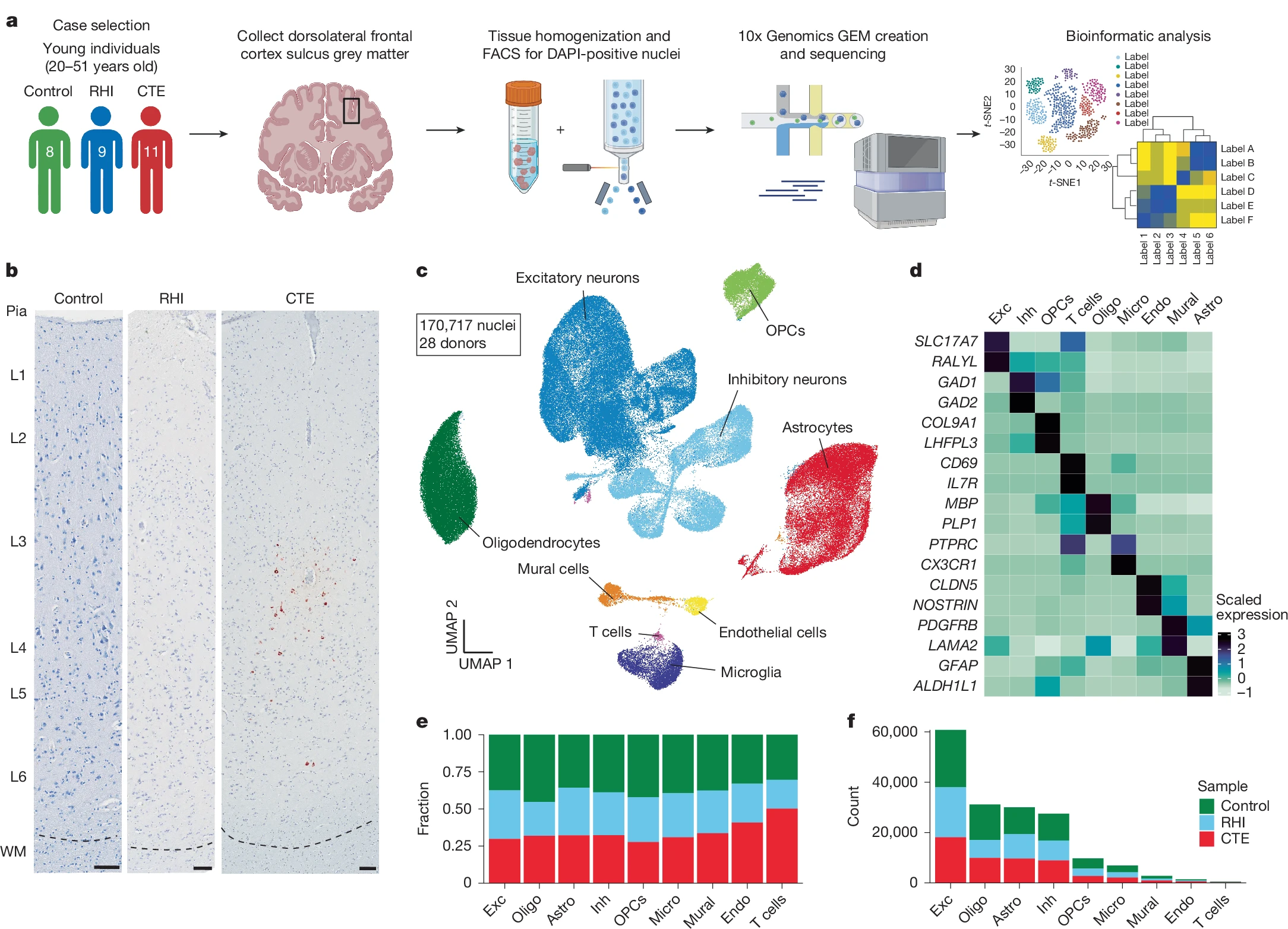 RNA sequencing study ties contact sports head hits to brain damage ...
