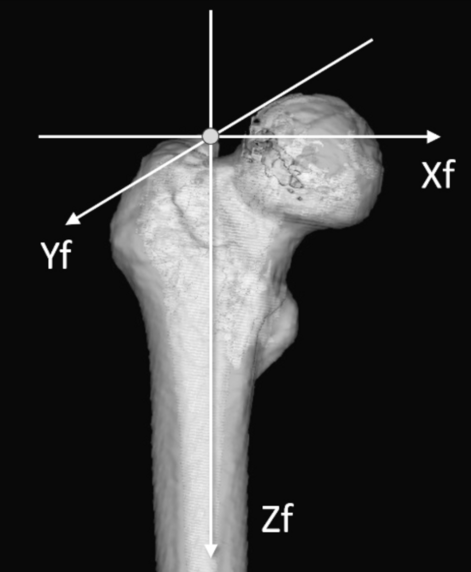 Greater Trochanter Of Femur