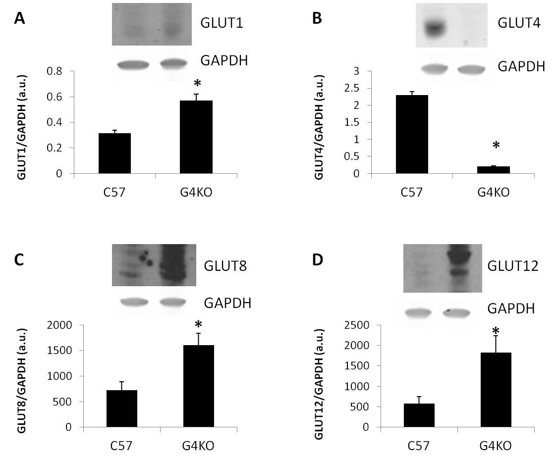 GLUT4, GLUT1, and GLUT8 are the dominant GLUT transcripts expressed in ...