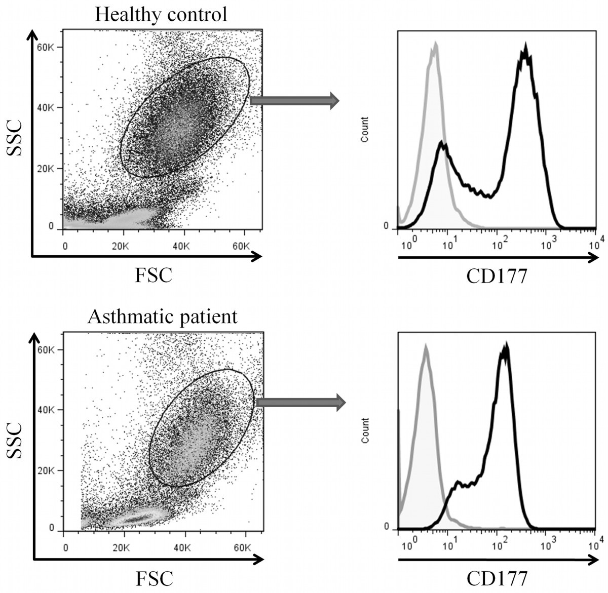 IL-17-producing peripheral blood CD177+ neutrophils increase in ...