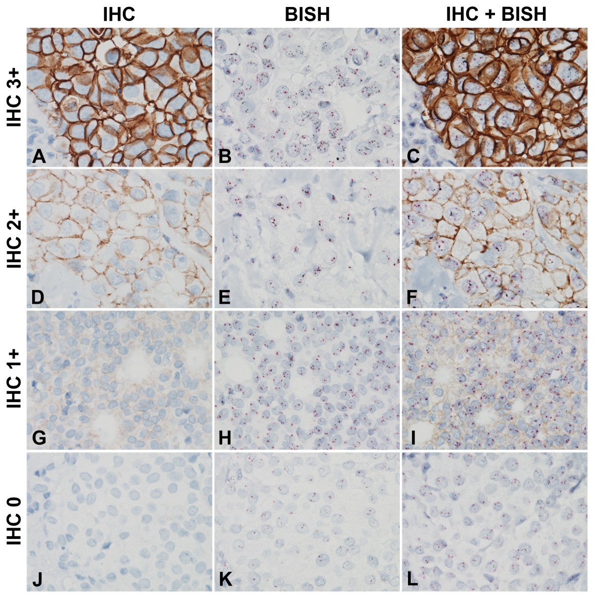 A gene-protein assay for human epidermal growth factor receptor 2 (HER2 ...