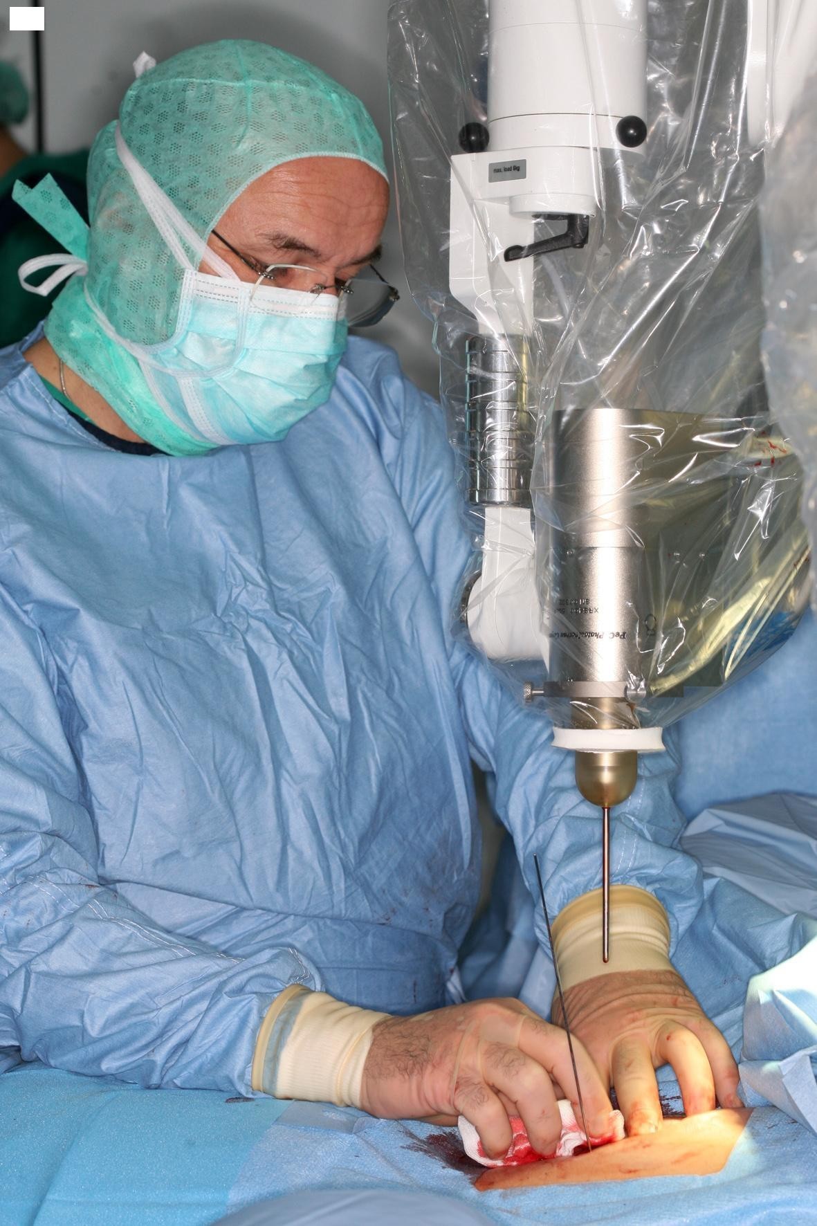 Kypho-IORT - a novel approach of intraoperative radiotherapy during ...