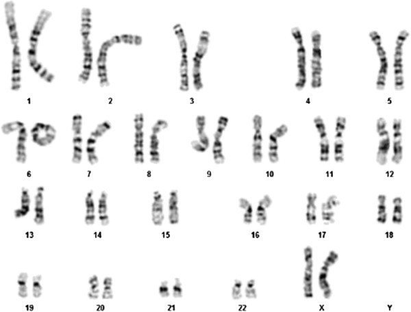 Array-CGH characterization and genotype-phenotype analysis in a patient ...