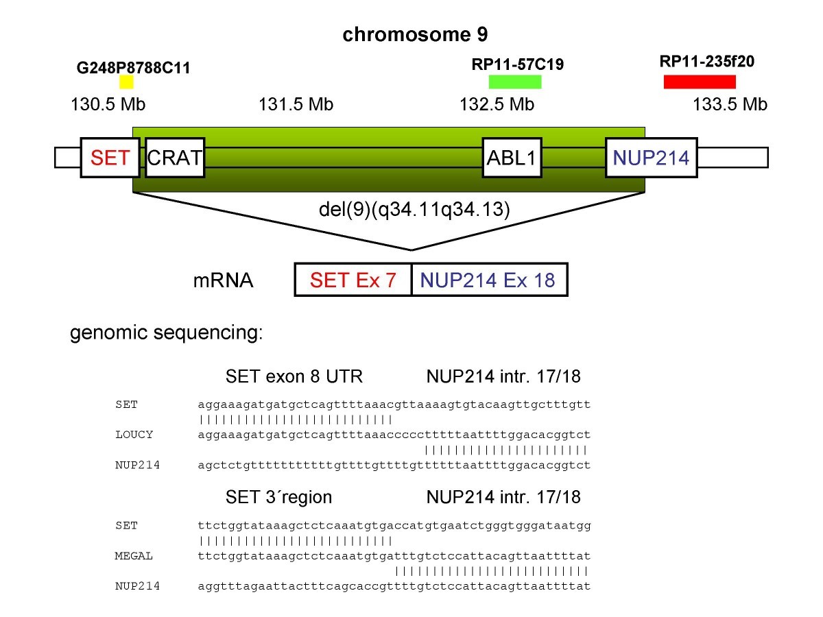 SET-NUP214 fusion in acute myeloid leukemia- and T-cell acute ...