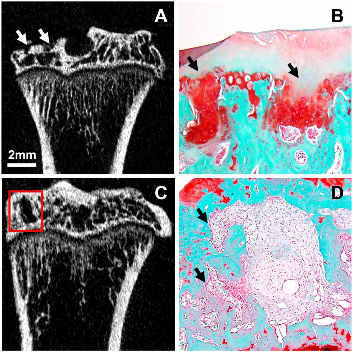 Application of in vivo micro-computed tomography in the temporal ...