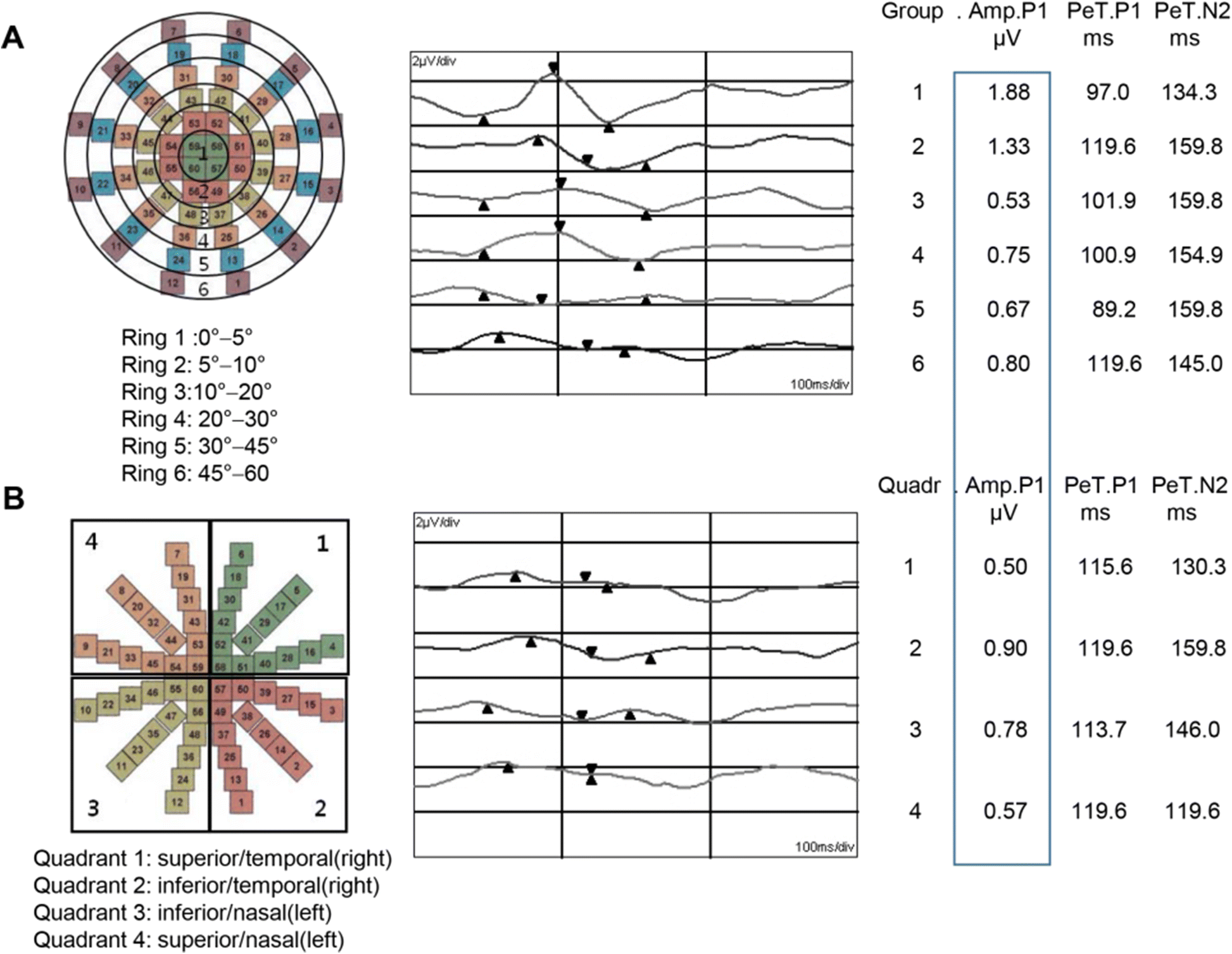 Assessing amblyopia treatment using multifocal visual evoked potentials ...