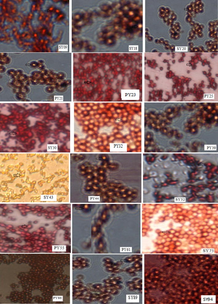 Oleaginous yeasts from Ethiopia | AMB Express | Full Text