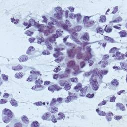 Das Paris-System zur Klassifikation der Urinzytologie | SpringerLink