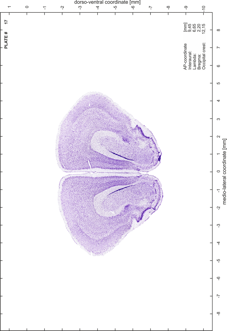 Brain atlas of the Mongolian gerbil ( Meriones unguiculatus ) in CT/MRI ...