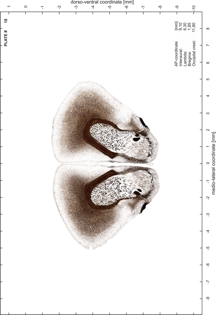 Brain atlas of the Mongolian gerbil ( Meriones unguiculatus ) in CT/MRI ...
