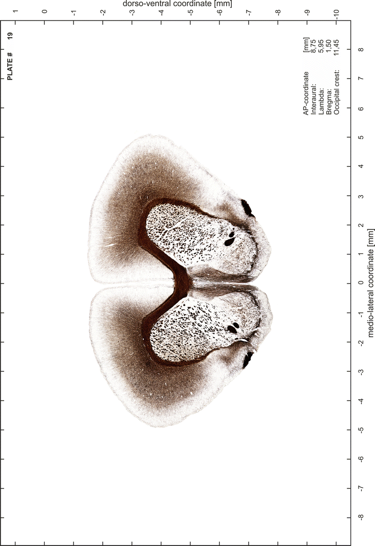 Brain atlas of the Mongolian gerbil ( Meriones unguiculatus ) in CT/MRI ...