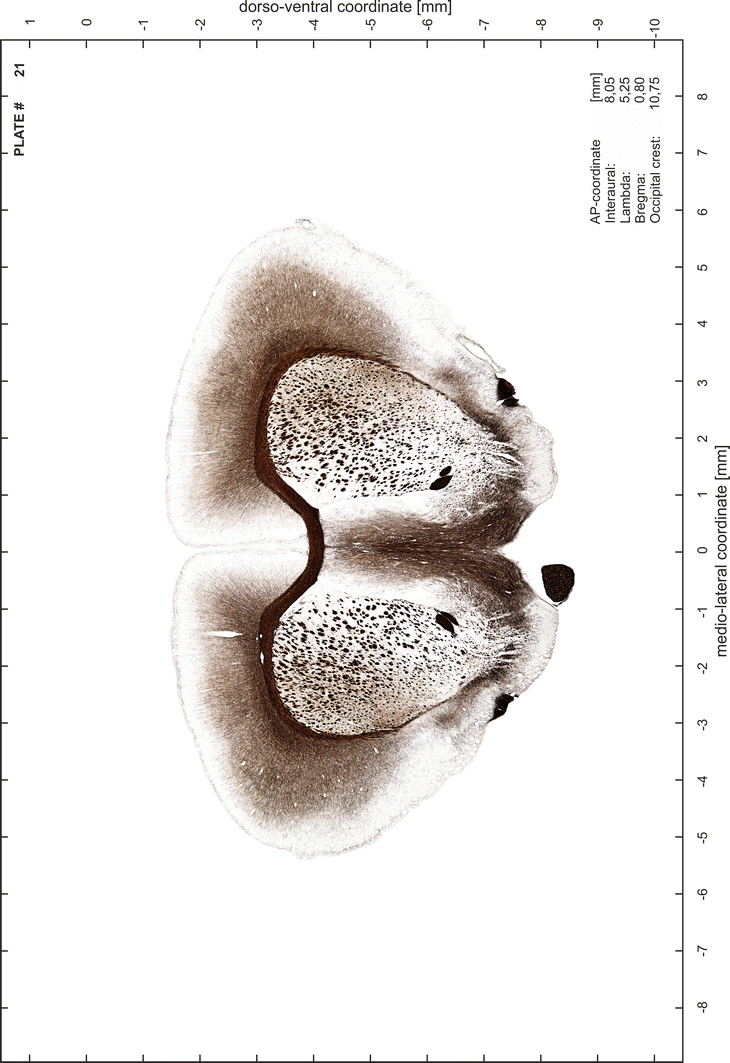 Brain atlas of the Mongolian gerbil ( Meriones unguiculatus ) in CT/MRI ...